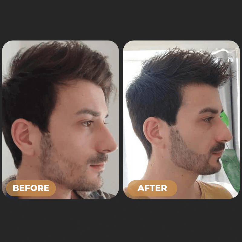 SPARTAN™ | Beard Growth Oil | Visible Results After 6 Weeks